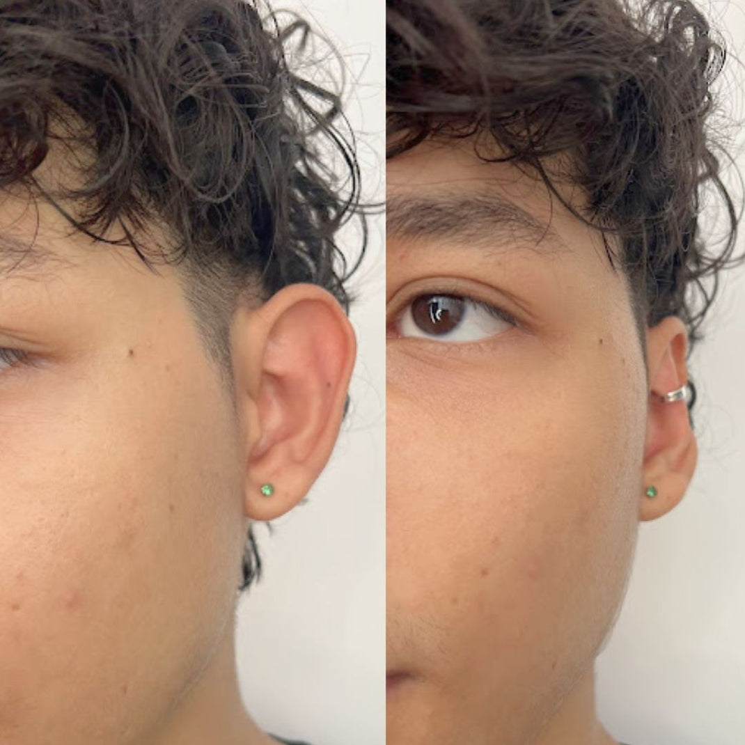 Clip Corrector de Orejas – Namaste Boutique